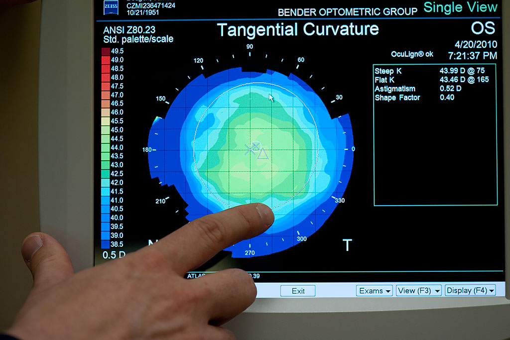 Corneal Topography – Bender Eye Tustin Optometrist