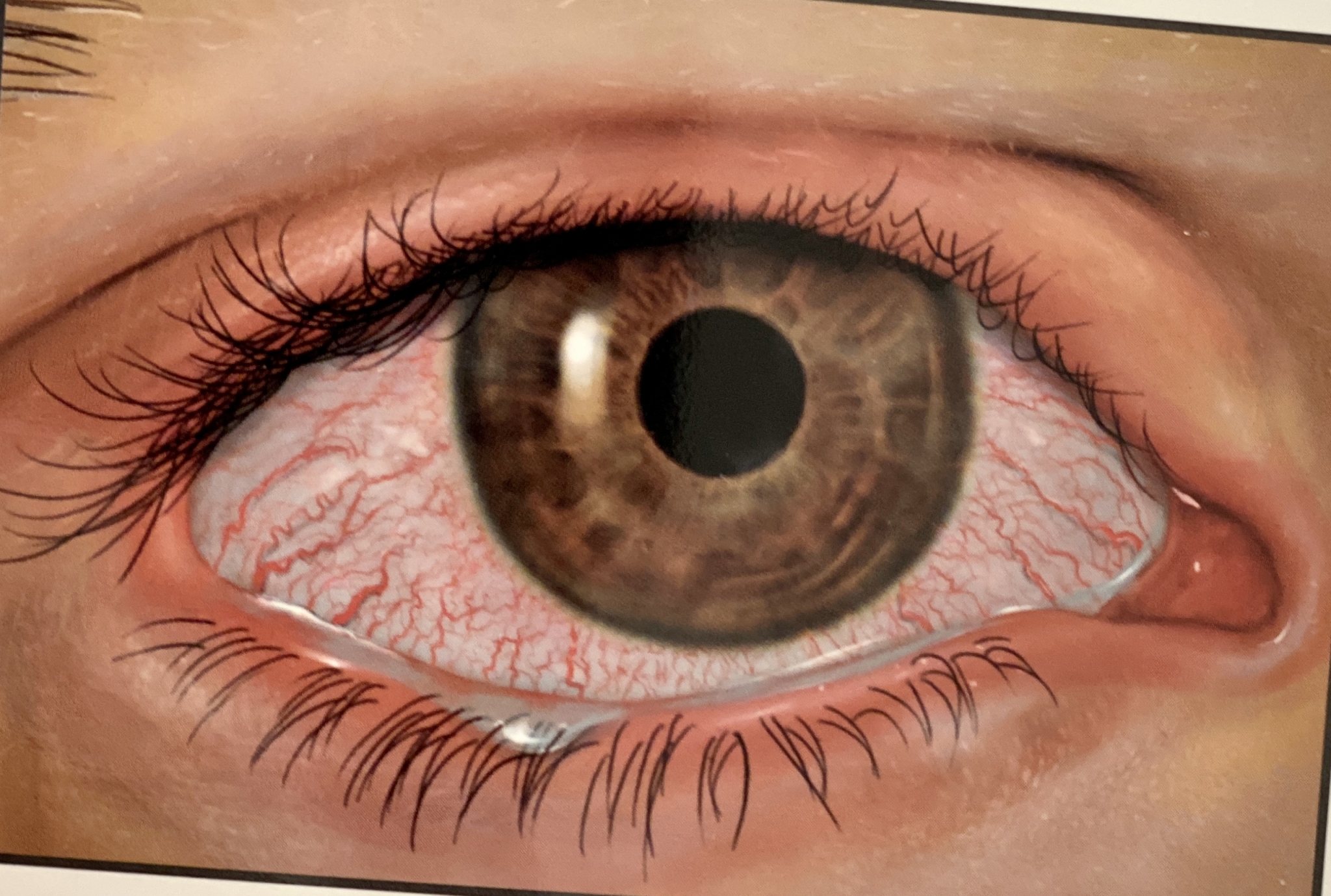 Bender Eye Tustin Optometrist – Bender Eye Optometry is a Tustin Eye Doctor